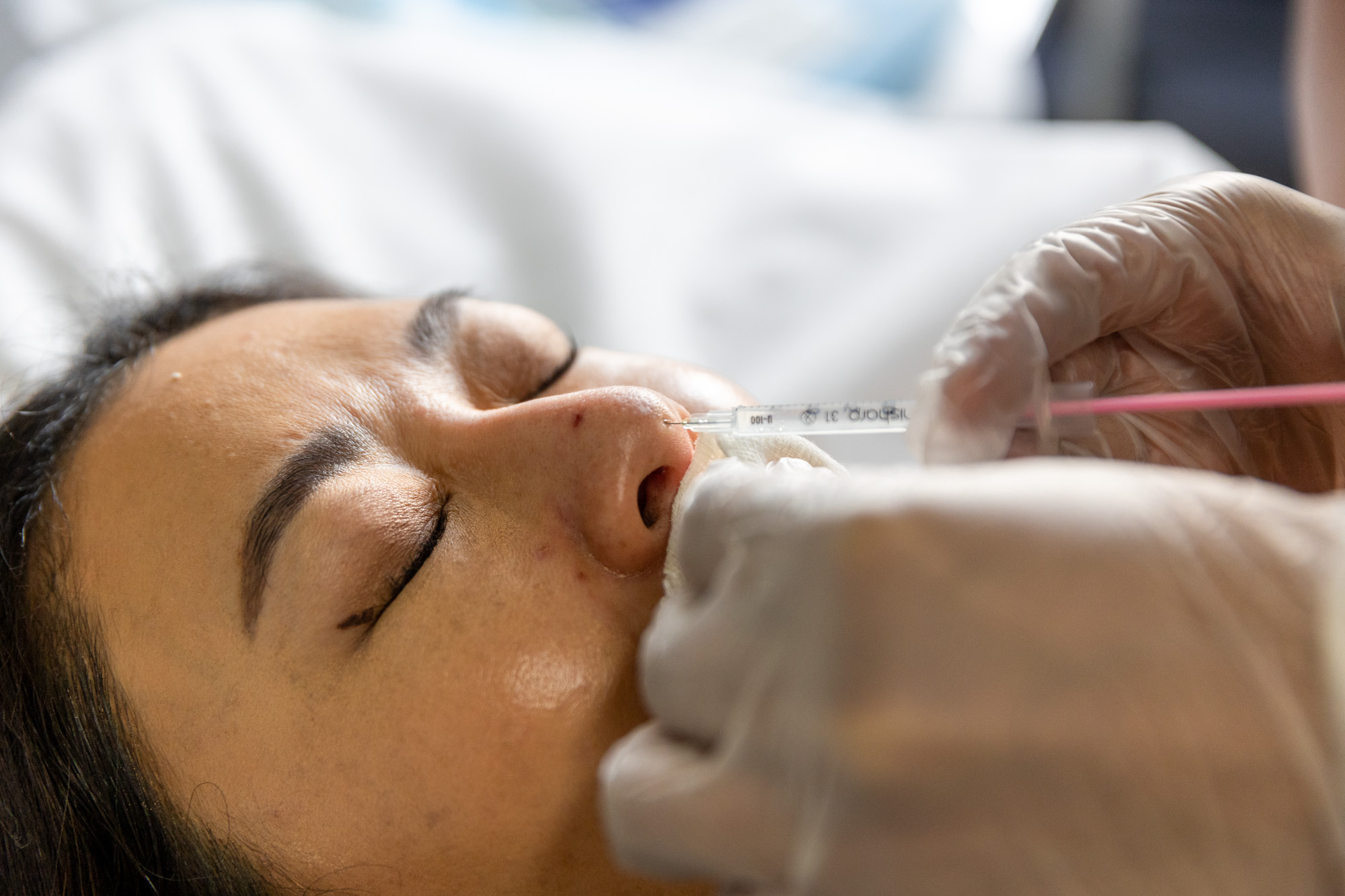 PDO Threads | Aesthetics Studio Australia PTY LTD